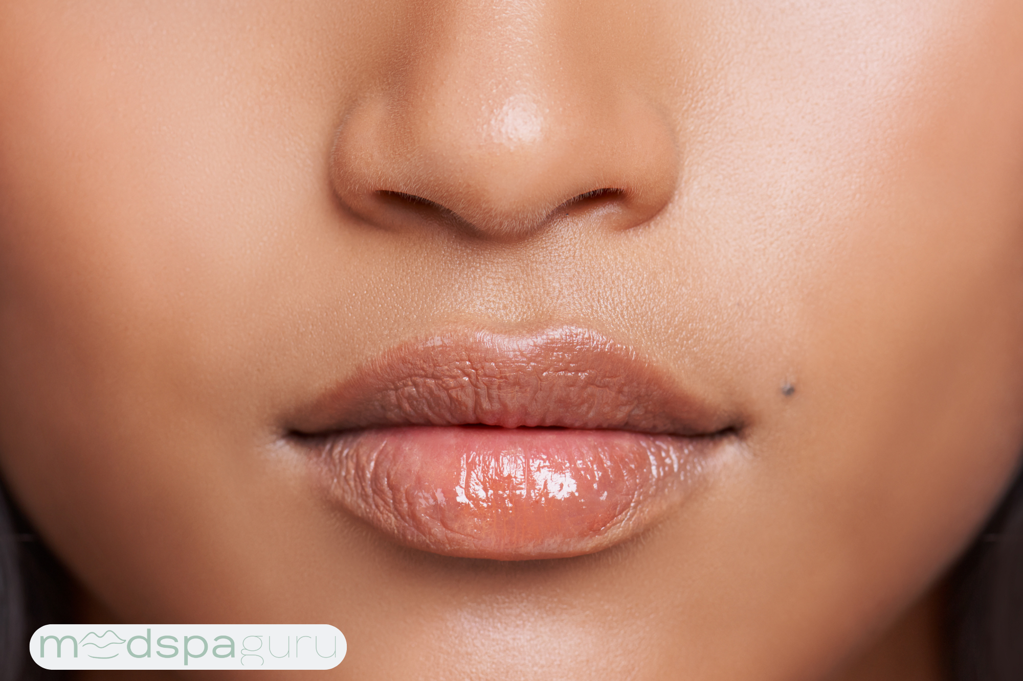 Why Lip Fillers Are The Beauty Solution